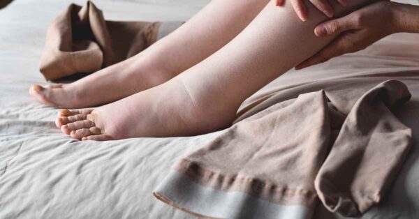 Healing a Broken Leg: Treatment and Nutritional Support for Faster ...